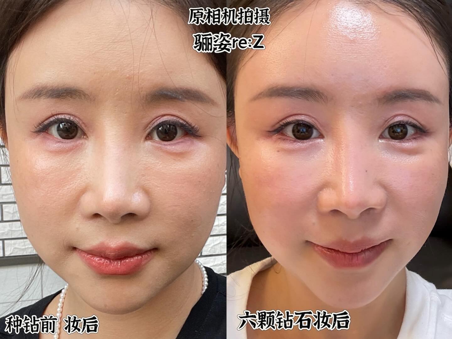 BEFORE/AFTER - rizzインターナショナルJAPAN